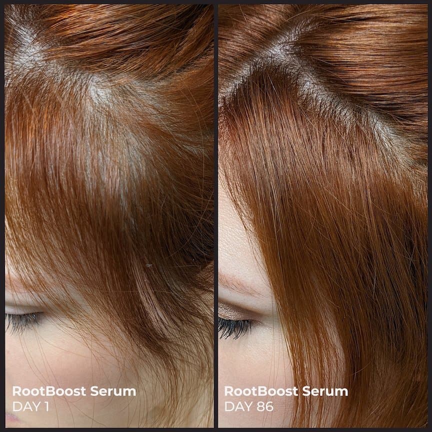 Better Roots RootBoost Serum | EVOLVh